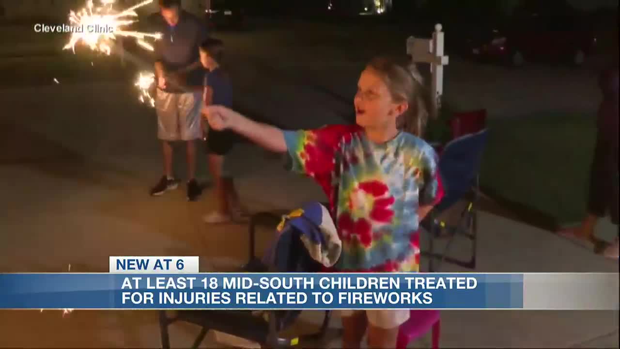 Sparkler Injuries