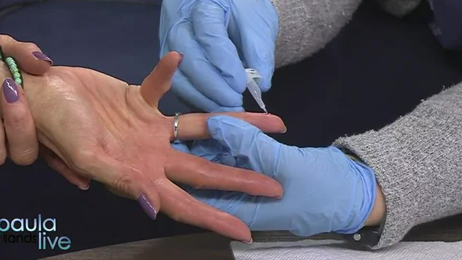 Embalming Photos Before And After